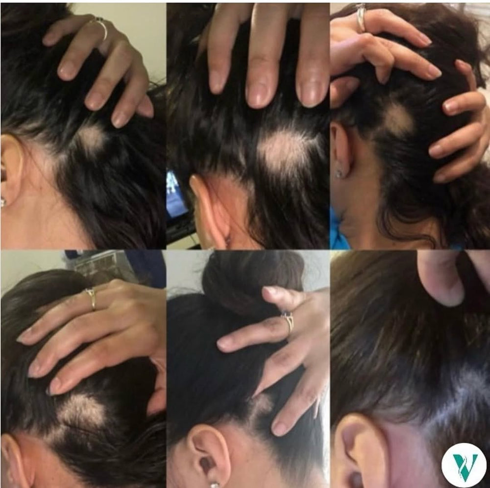 Vida Testimonials – Vida Hair Growth